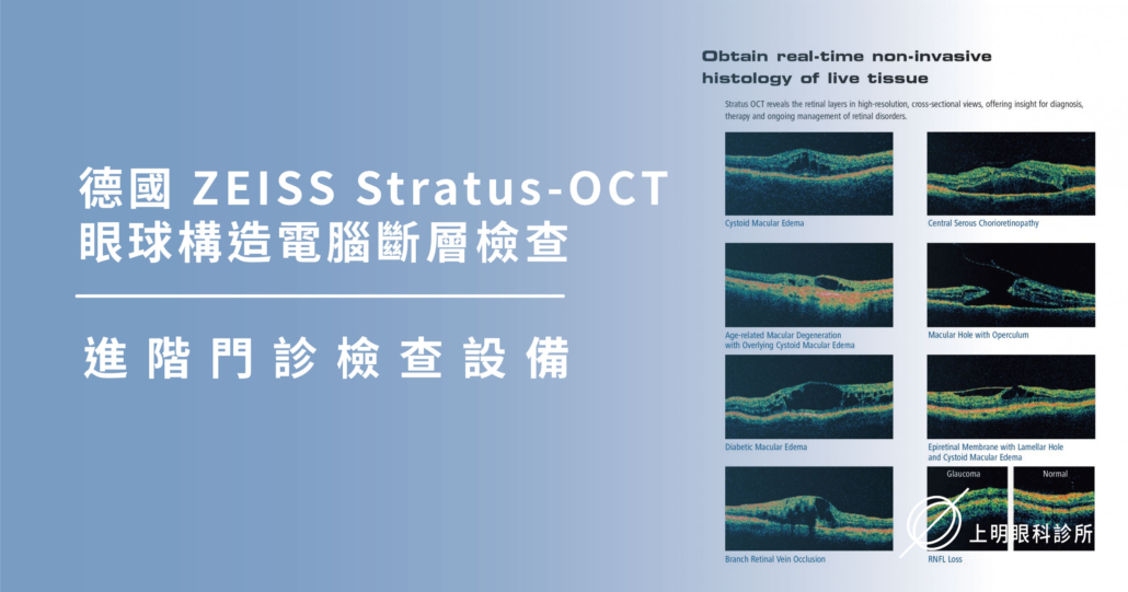 進階門診檢查設備｜德國 ZEISS Stratus-OCT 眼球構造電腦斷層檢查 - 上明眼科